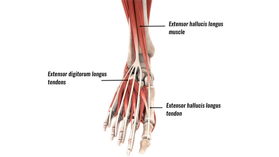 Extensor Tendonitis Rehabilitation - SportsRehab.App