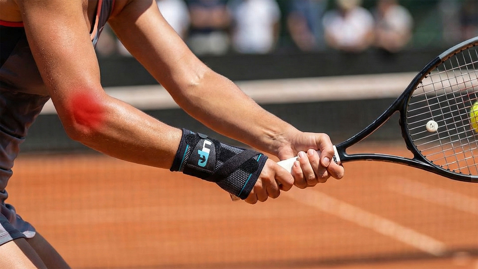 Wrist Splints for Tennis Elbow? - SportsRehab.App